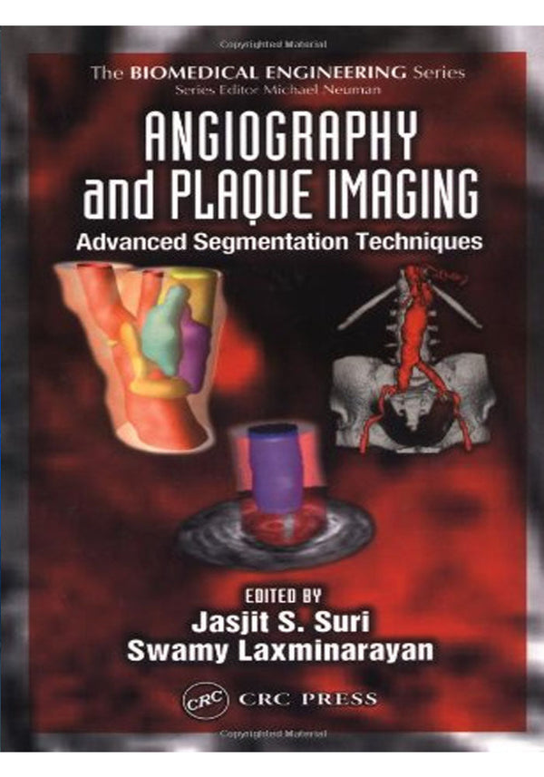 Angiography and Plaque Imaging Advanced Segmentation Techniques Angiography and Plaque Imaging Advanced Segmentation Techniques