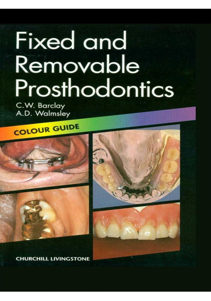 Fixed and Removable Prosthodontics: Color Guide (Color Guides) 2nd Edi ...